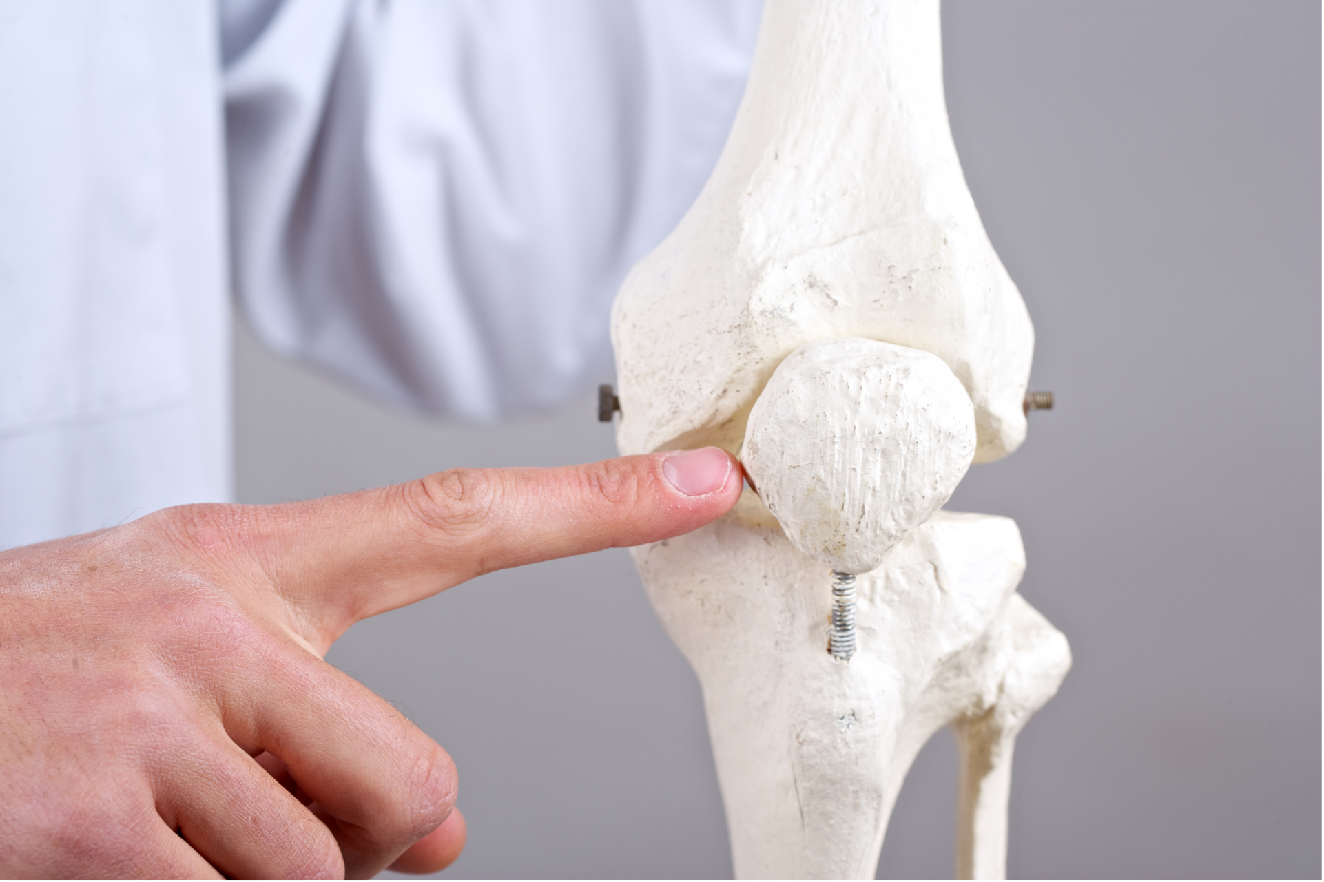 Condromalácia grau 3 precisa de cirurgia? - Dr. Reinaldo Keitiro ...